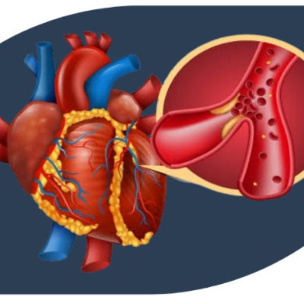 Ibn Sina Specialized Hospital - Coronary artery catheterization